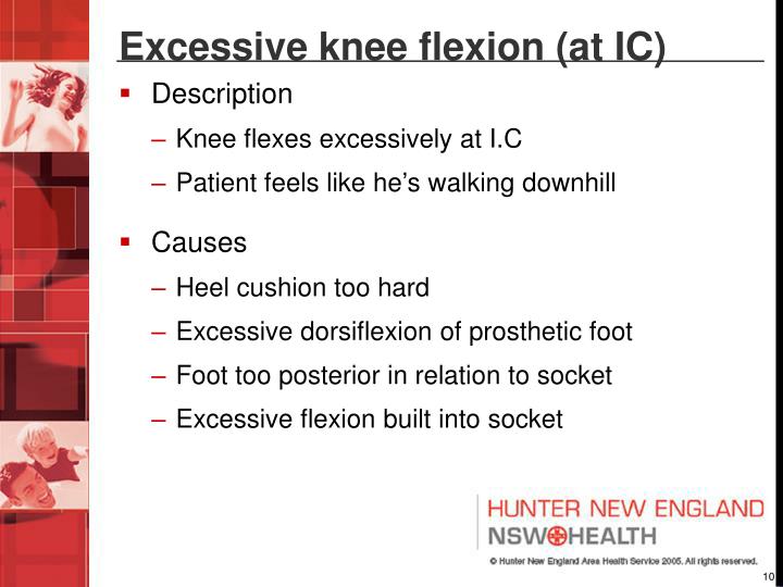 PPT - Prosthetic Gait Deviations PowerPoint Presentation - ID:6571061