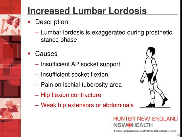 PPT - Prosthetic Gait Deviations PowerPoint Presentation - ID:6571061