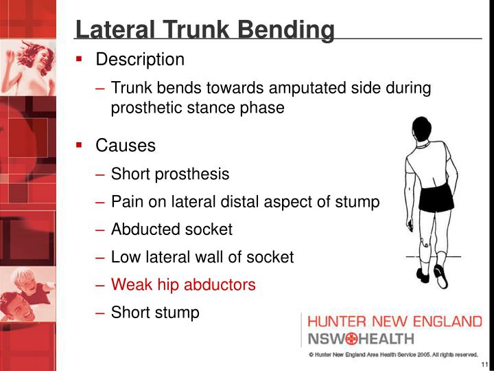 PPT - Prosthetic Gait Deviations PowerPoint Presentation - ID:6571061