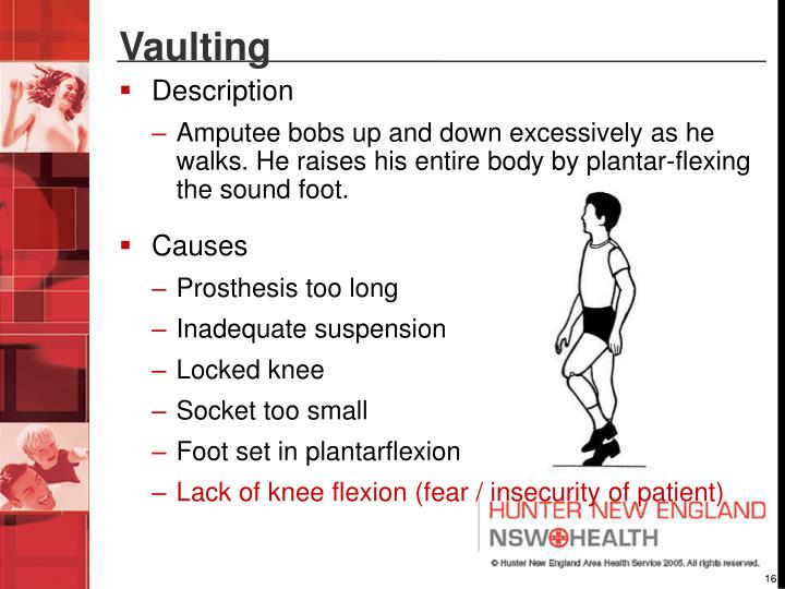 PPT - Prosthetic Gait Deviations PowerPoint Presentation - ID:6571061