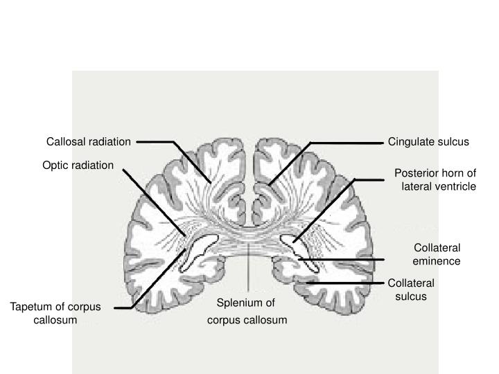 PPT - Meninges, CSF & Ventricular system PowerPoint Presentation - ID ...