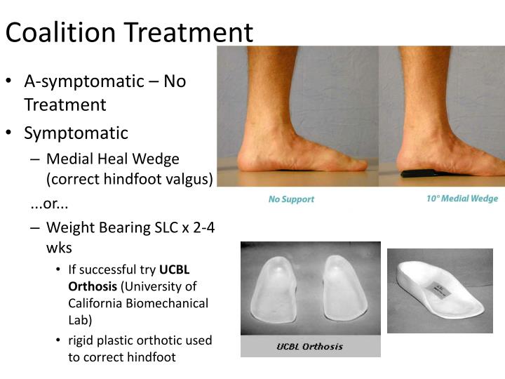 PPT - Tarsal Coalition PowerPoint Presentation - ID:6578156