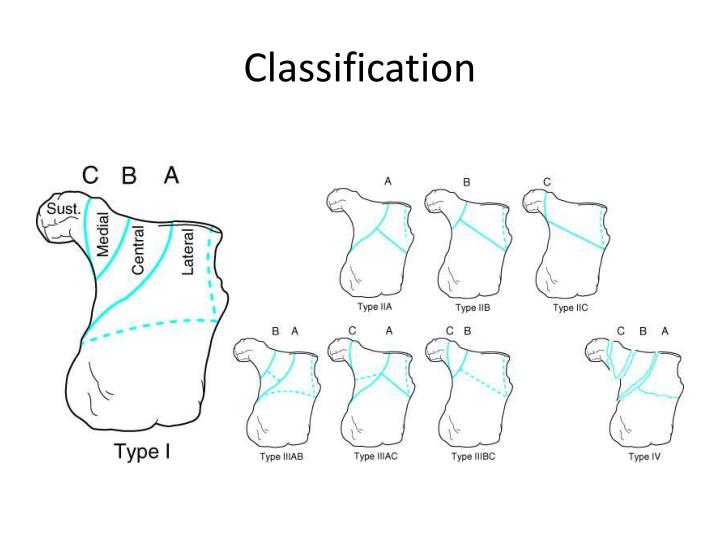 PPT - Calcaneal Fractures PowerPoint Presentation - ID:6578166