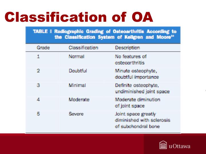 PPT - Ankle Arthrodesis PowerPoint Presentation - ID:6578216
