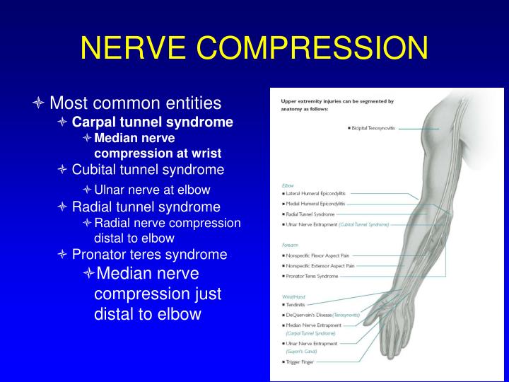 PPT - Hand and Wrist Injuries PowerPoint Presentation - ID:6578577