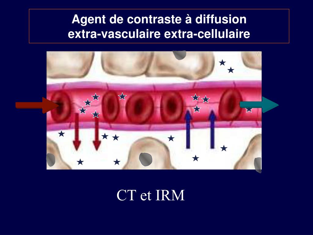 PPT - Imagerie de la perfusion tissulaire: en IRM dynamique DCE-MRI ...