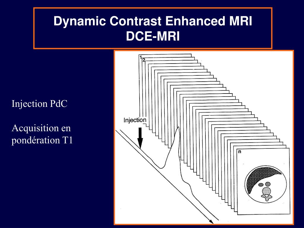 PPT - Imagerie de la perfusion tissulaire: en IRM dynamique DCE-MRI ...