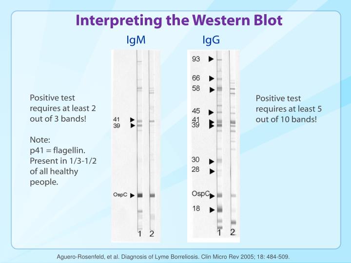 PPT - Understanding Laboratory Testing for Lyme Disease PowerPoint ...