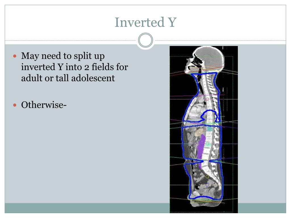 PPT - Hodgkin’s Lymphoma PowerPoint Presentation, free download - ID ...