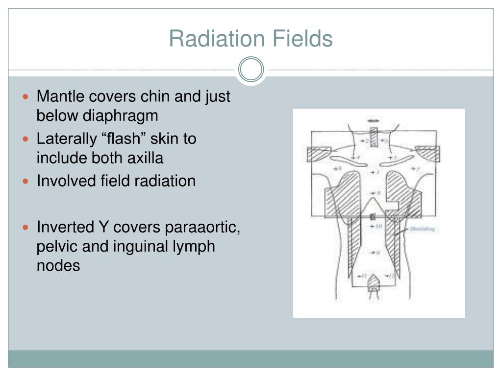 PPT - Hodgkin’s Lymphoma PowerPoint Presentation, free download - ID ...