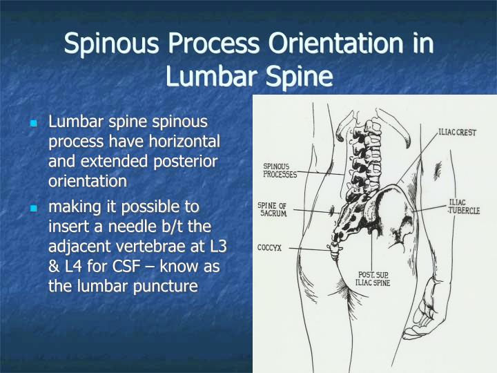 PPT - Lumbar Spine PowerPoint Presentation - ID:6582772