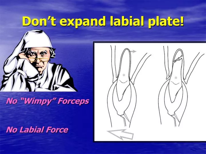 PPT - Don’t expand labial plate! PowerPoint Presentation, free download ...