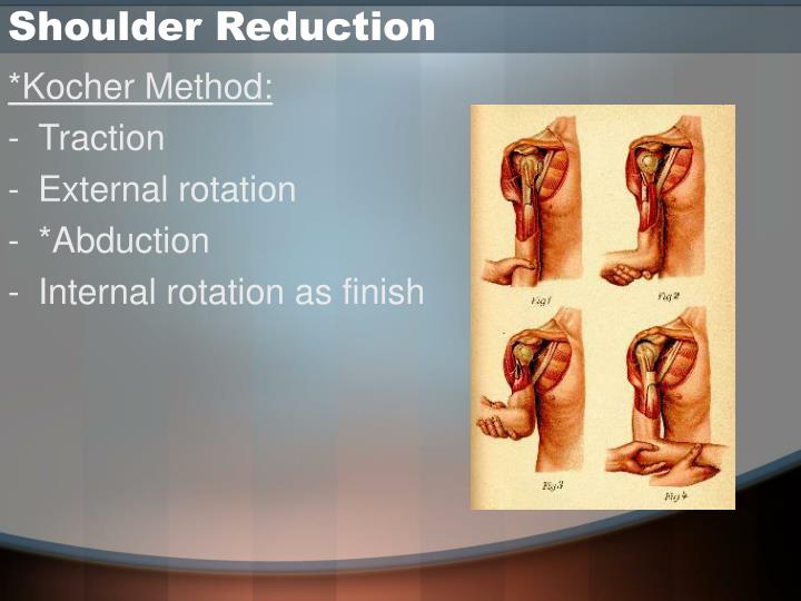 PPT - Applied ER Ortho: Upper Limb Fractures “Tips and Tricks ...