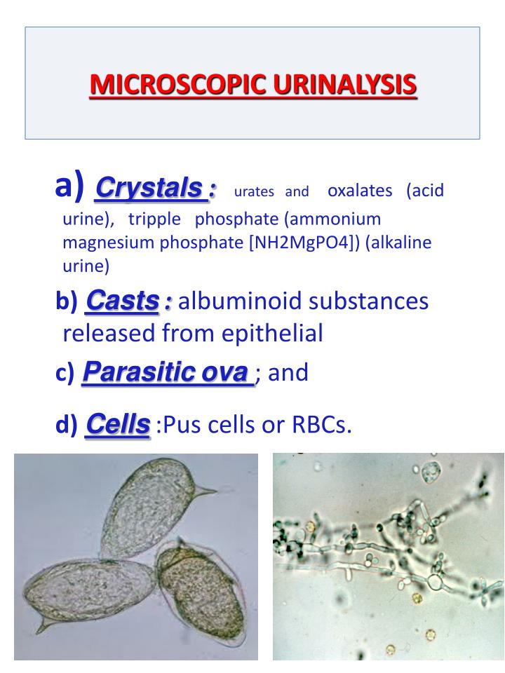 PPT - Urine Analysis PowerPoint Presentation - ID:6585992