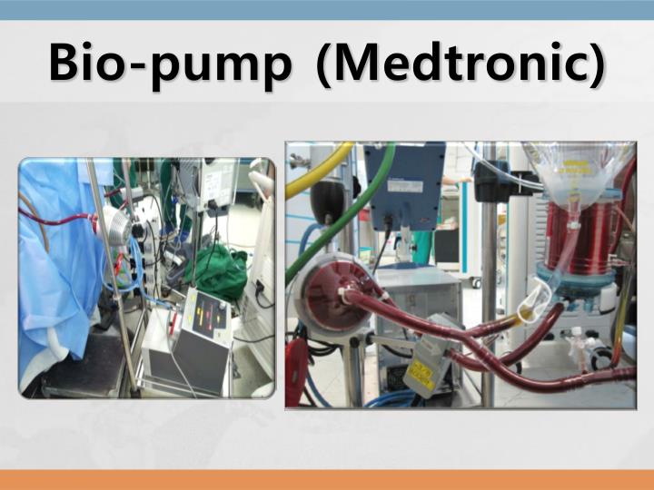 PPT - ECMO (U nderstanding and Management ) PowerPoint Presentation ...