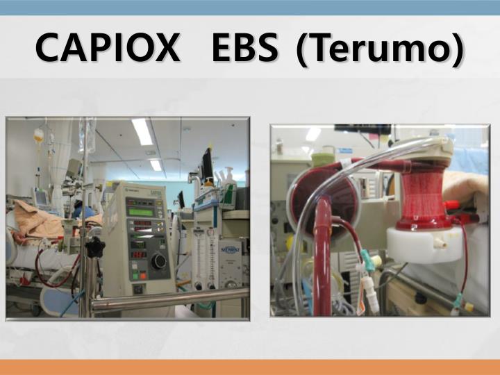PPT - ECMO (U nderstanding and Management ) PowerPoint Presentation ...