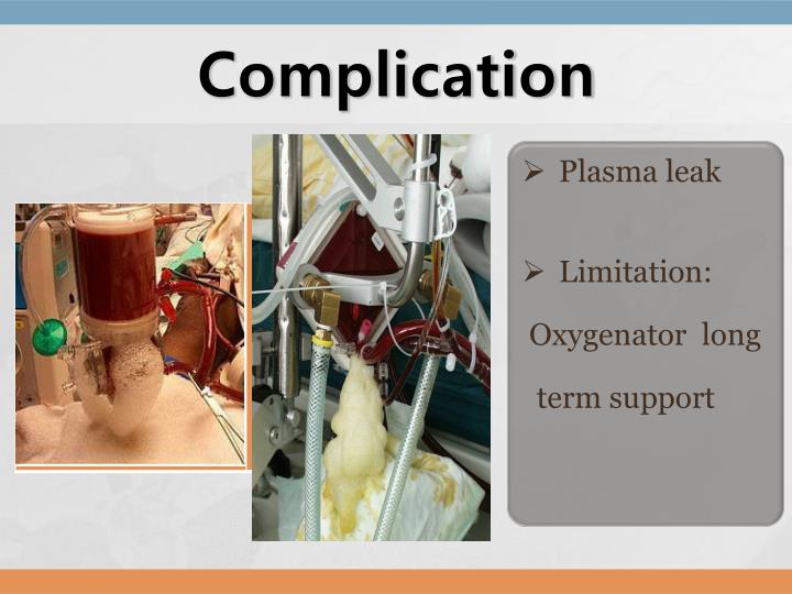 PPT - ECMO (U nderstanding and Management ) PowerPoint Presentation ...