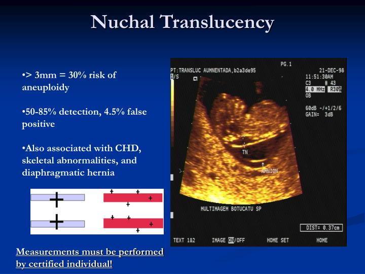 PPT - First Trimester Screening PowerPoint Presentation - ID:6590649