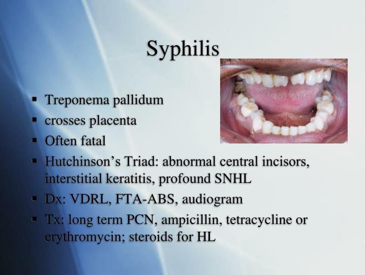 PPT - Congenital Hearing Loss PowerPoint Presentation - ID:6590725