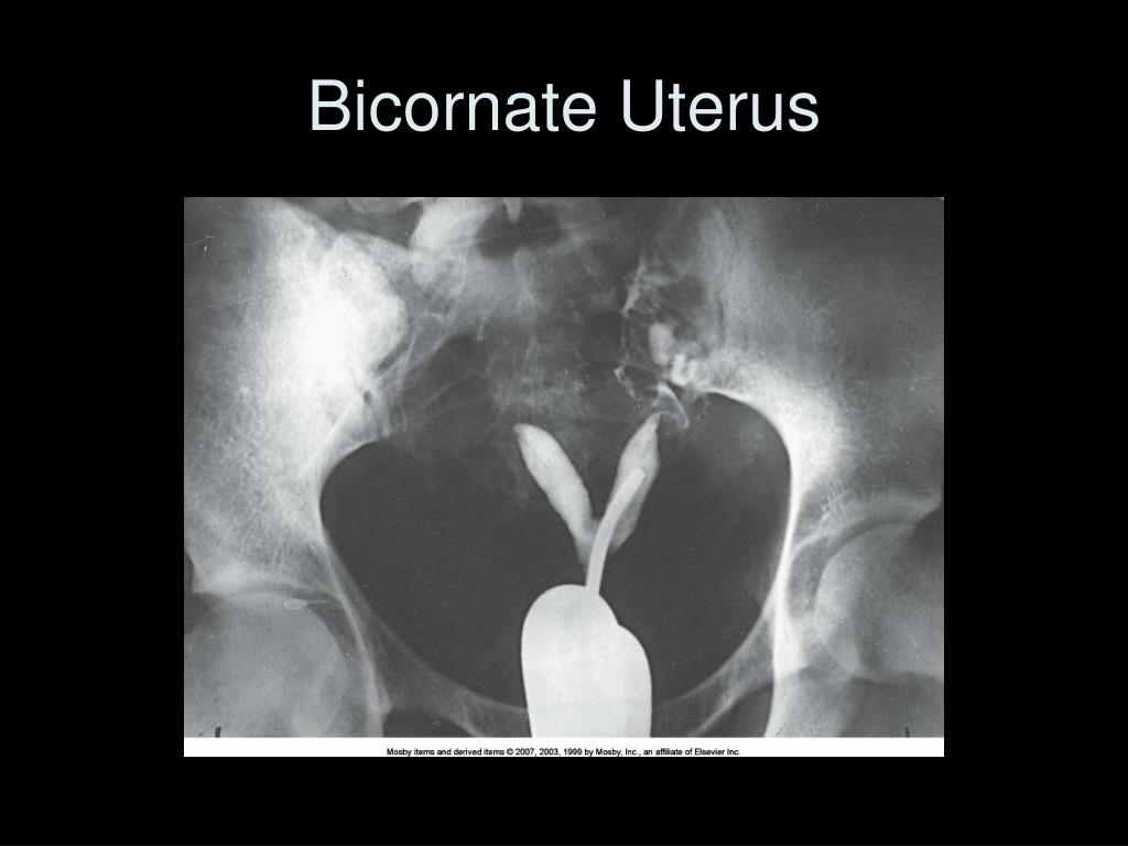 PPT - Female and Male Reproductive System & HSG and Prostate Imaging ...
