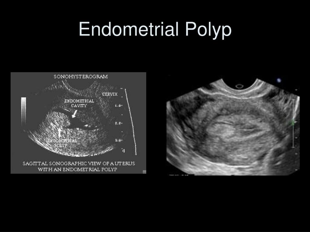 PPT - Female and Male Reproductive System & HSG and Prostate Imaging ...