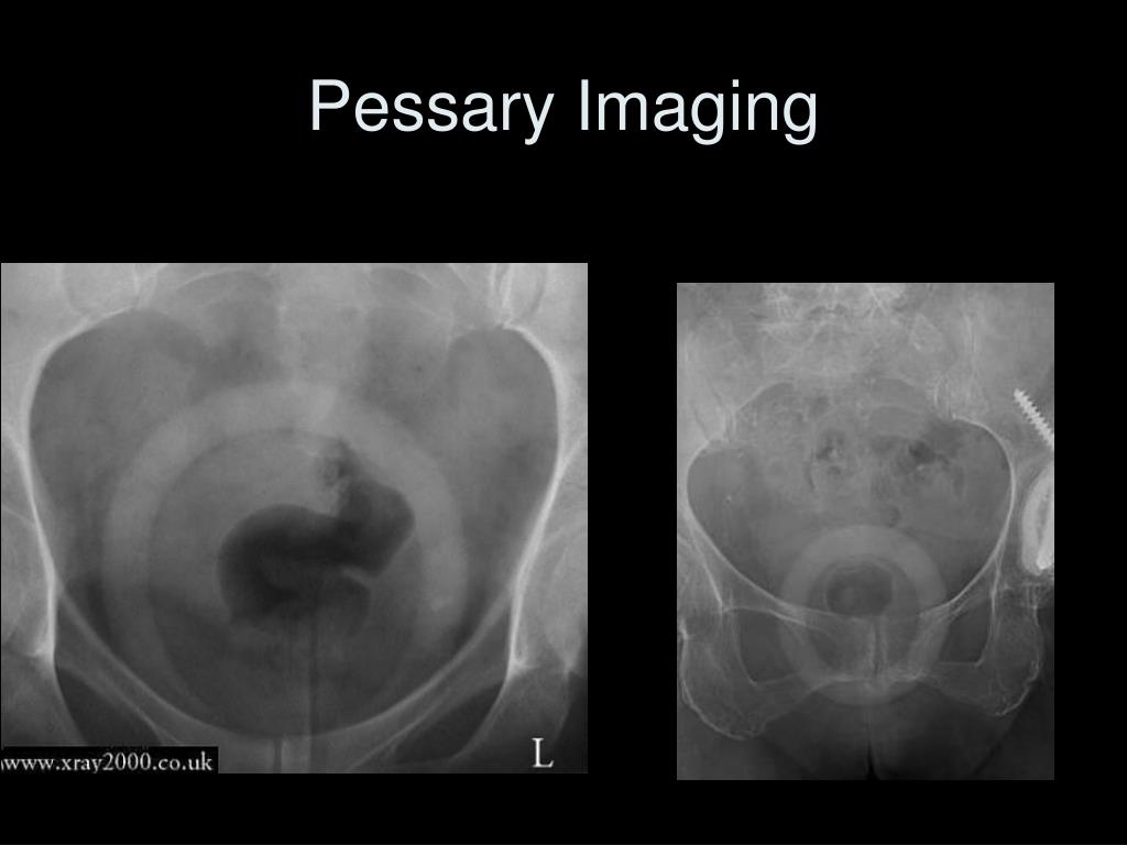 PPT - Female and Male Reproductive System & HSG and Prostate Imaging ...