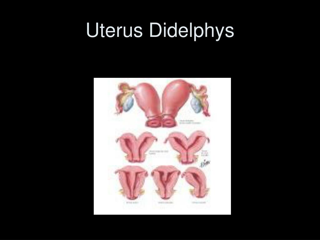 Ppt Female And Male Reproductive System And Hsg And Prostate Imaging