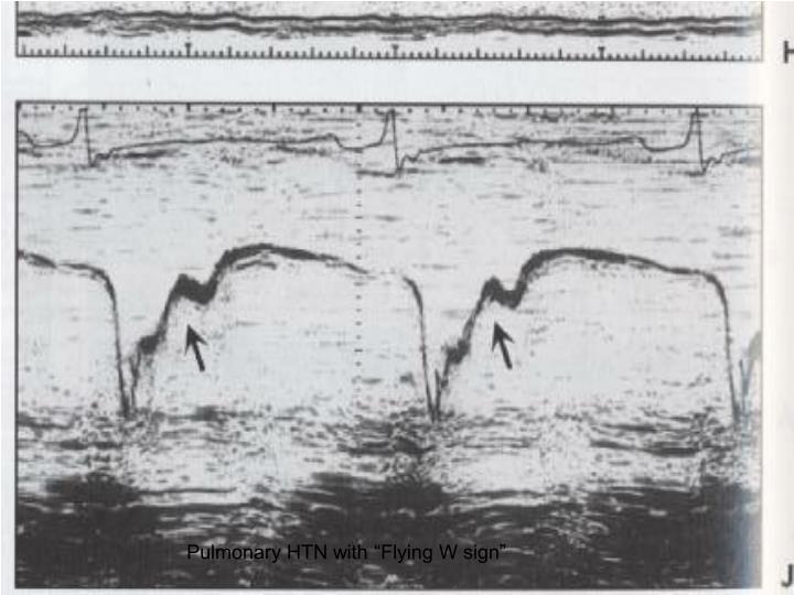 PPT - M-Mode Echocardiography PowerPoint Presentation - ID:6591486