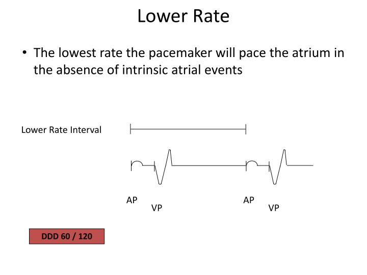 PPT - BASICS OF PACEMAKER PowerPoint Presentation - ID:6593572