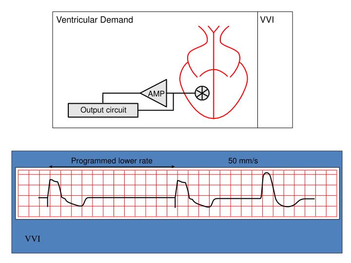 PPT - BASICS OF PACEMAKER PowerPoint Presentation - ID:6593572