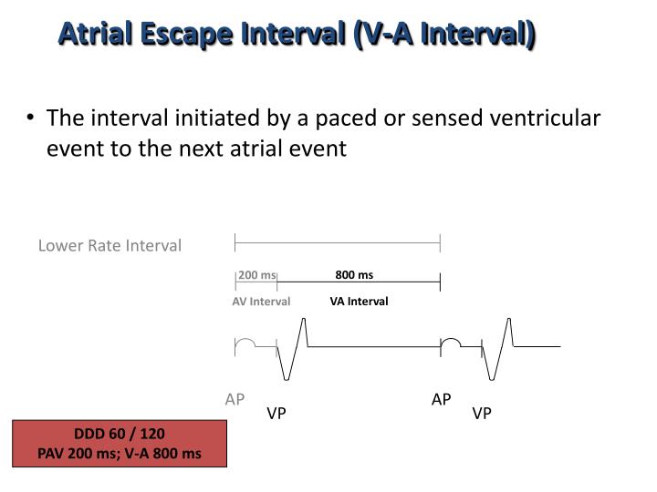 PPT - BASICS OF PACEMAKER PowerPoint Presentation - ID:6593572