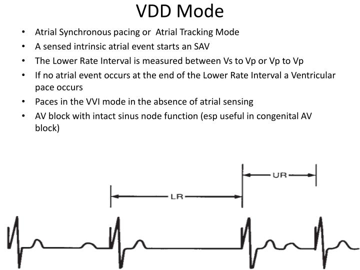 PPT - BASICS OF PACEMAKER PowerPoint Presentation - ID:6593572