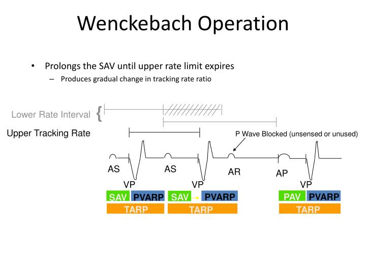 PPT - BASICS OF PACEMAKER PowerPoint Presentation - ID:6593572
