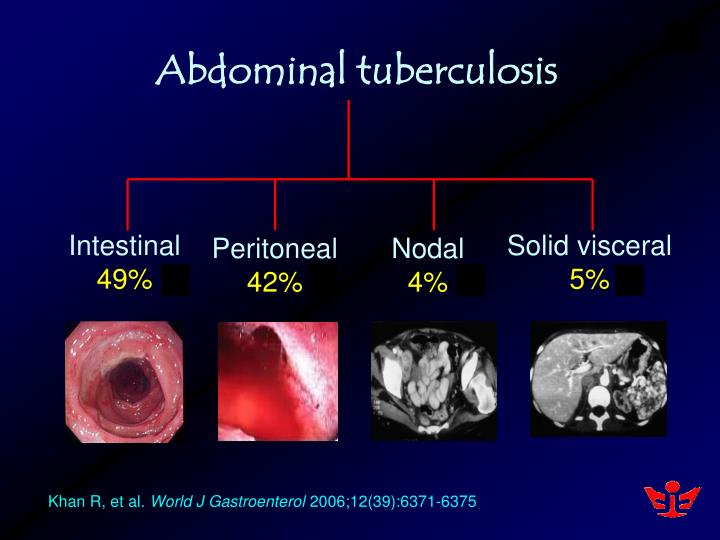 PPT - Management of Abdominal Tuberculosis Joint Hospital Surgical ...