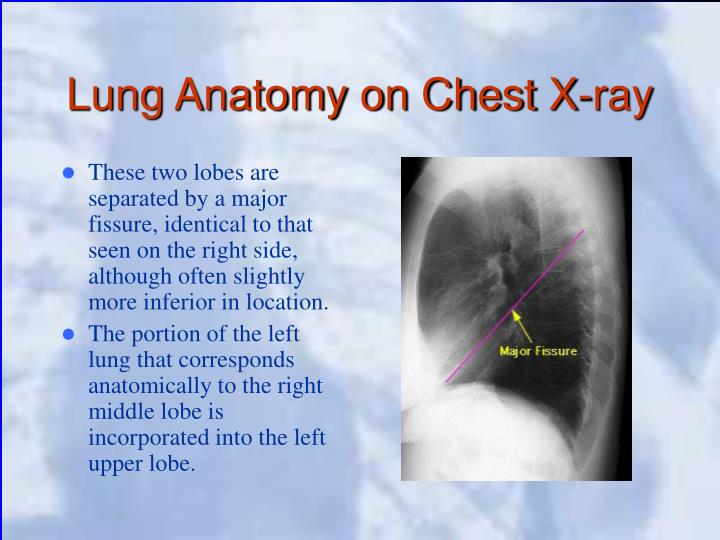 PPT - Chest X-ray Interpretation PowerPoint Presentation - ID:6594148