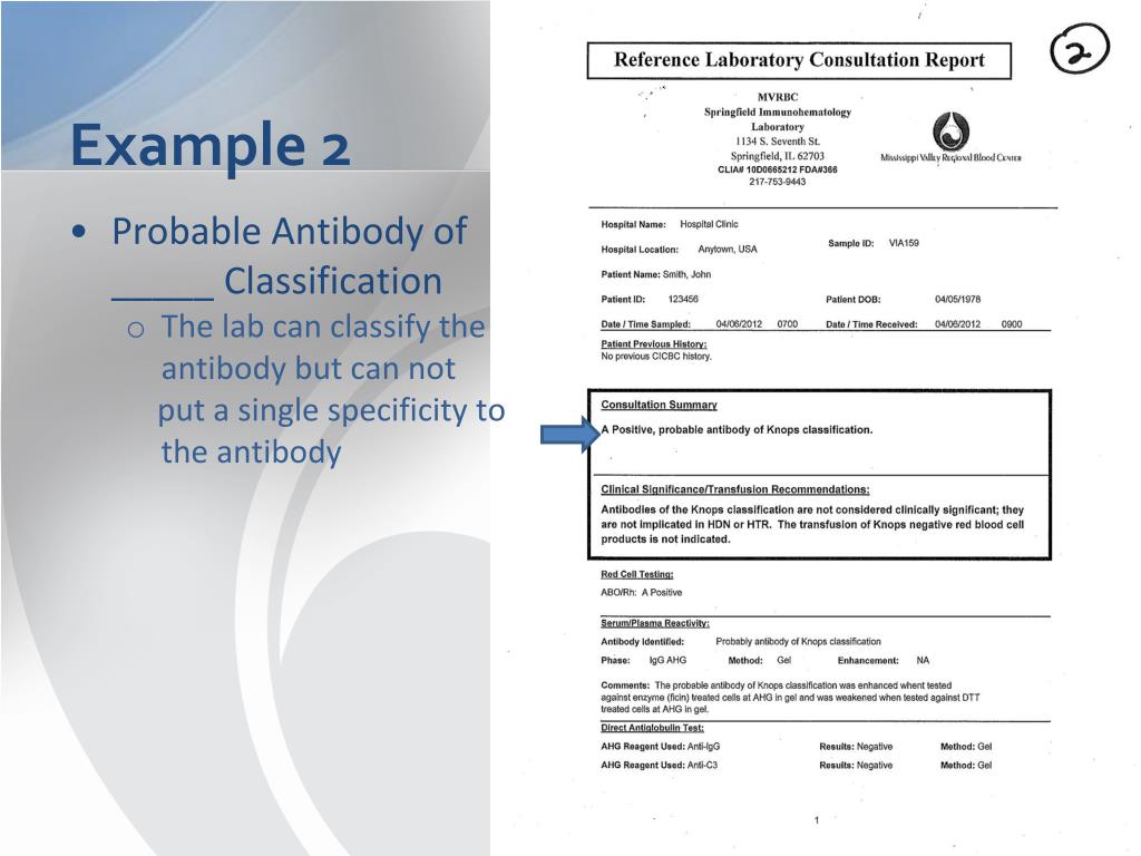 PPT - Antibodies Formerly Known as ‘High-Titer, Low-Avidity (HTLA ...