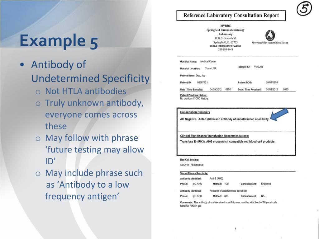 PPT - Antibodies Formerly Known as ‘High-Titer, Low-Avidity (HTLA ...