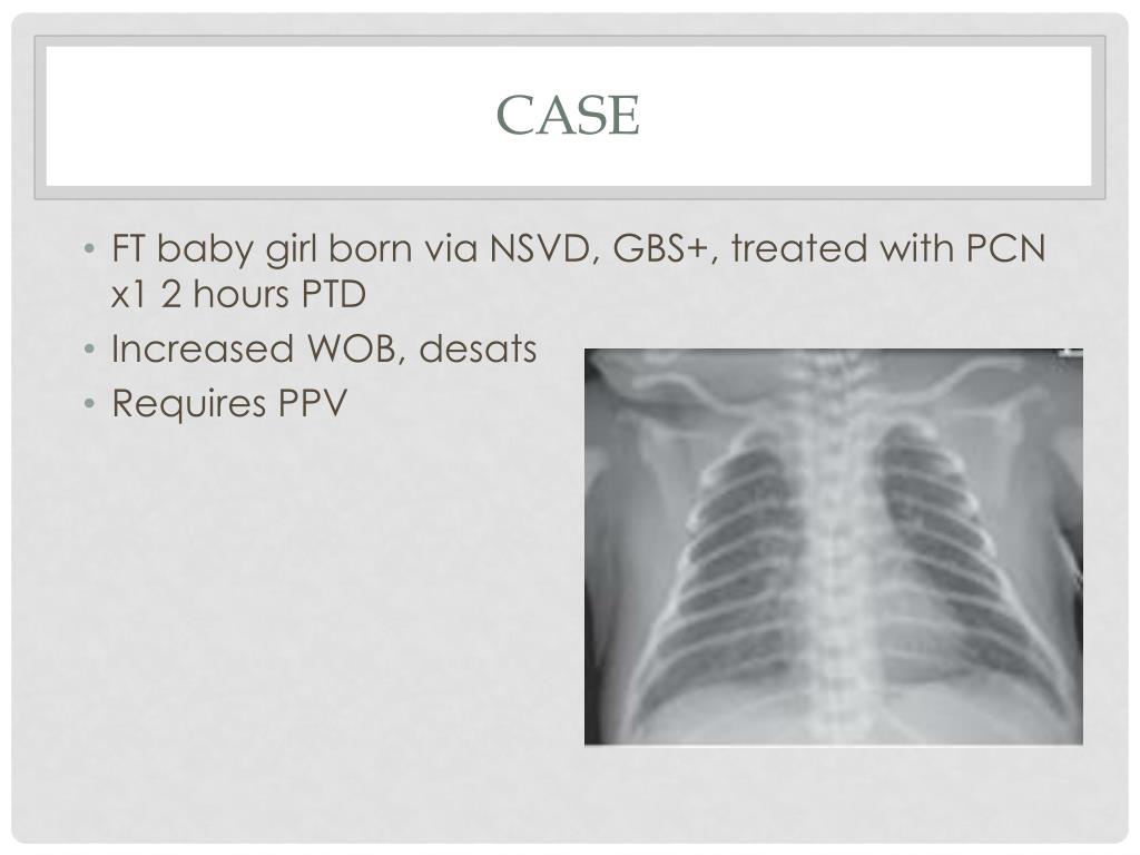 PPT - Respiratory distress In the full term neonate PowerPoint ...