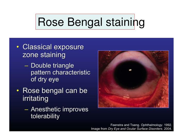 PPT - Dry eyes PowerPoint Presentation - ID:6594786