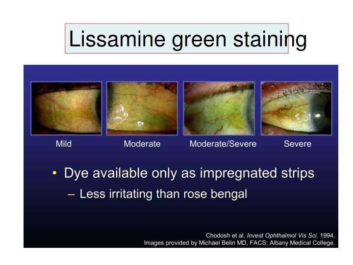 PPT - Dry eyes PowerPoint Presentation - ID:6594786