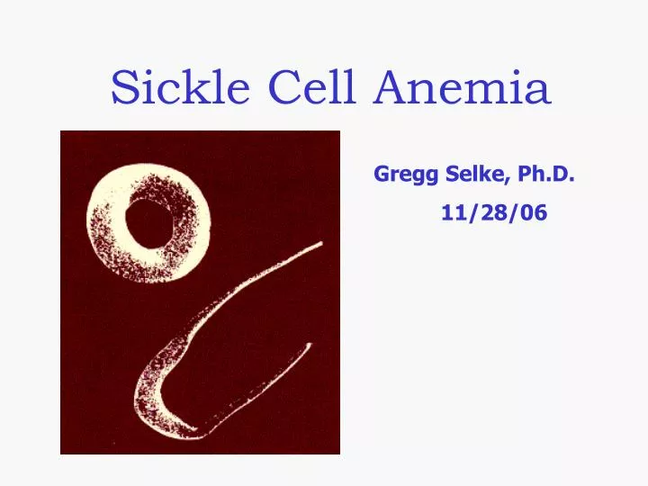 Ppt Sickle Cell Anemia Powerpoint Presentation Free Download Id6595016