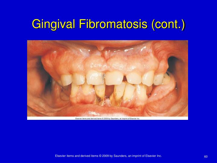 PPT - Chapter 6 Genetics PowerPoint Presentation - ID:6595247