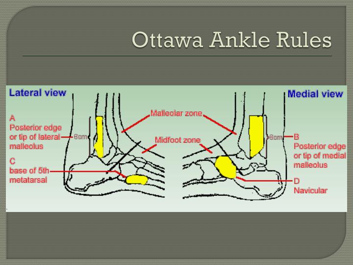 PPT - Ankle Fractures PowerPoint Presentation - ID:6596983