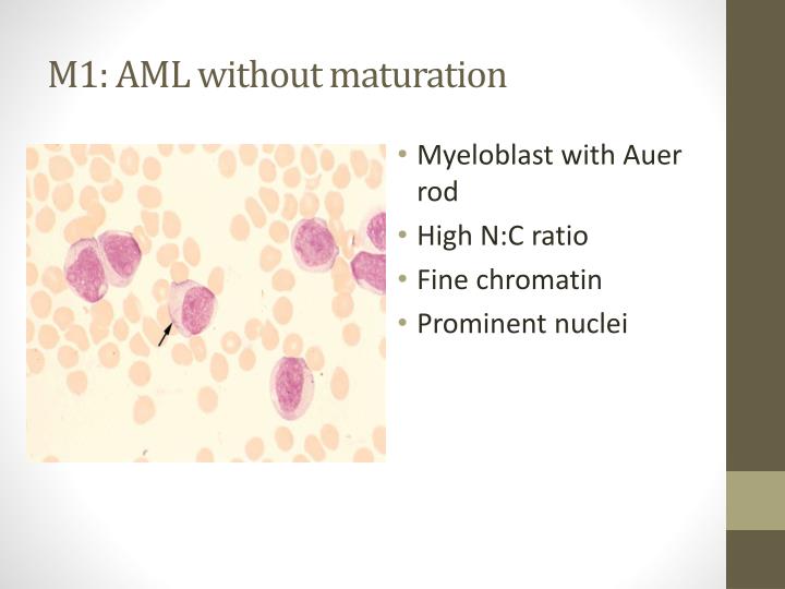 PPT - Acute Myeloid Leukemias (AML) PowerPoint Presentation - ID:6597338