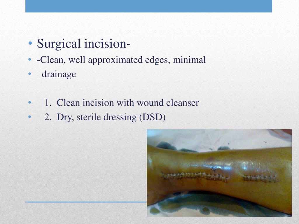 PPT - Wound care and Dressings PowerPoint Presentation, free download ...