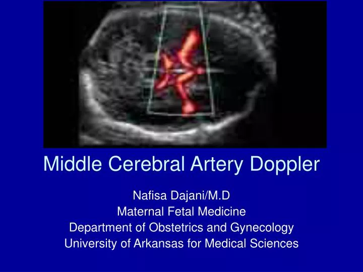 PPT - Middle Cerebral Artery Doppler PowerPoint Presentation, free ...