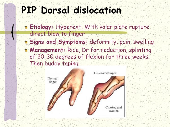 PPT - Wrist and Hand Unit PowerPoint Presentation - ID:6598649