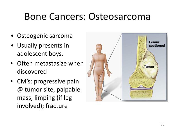 PPT - Common Orthopedic Problems of Children PowerPoint Presentation ...