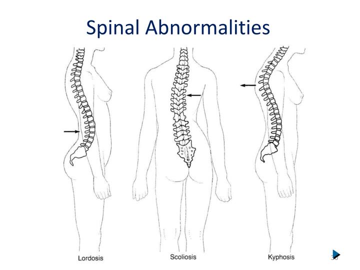 PPT - Common Orthopedic Problems of Children PowerPoint Presentation ...