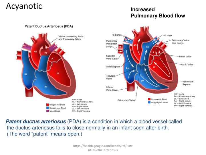 PPT - Chapter 31- Care of Child with a Physical Disorder PowerPoint ...